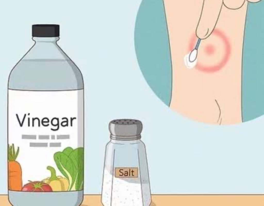 Natural Cures For Ringworm Infections - School Drillers